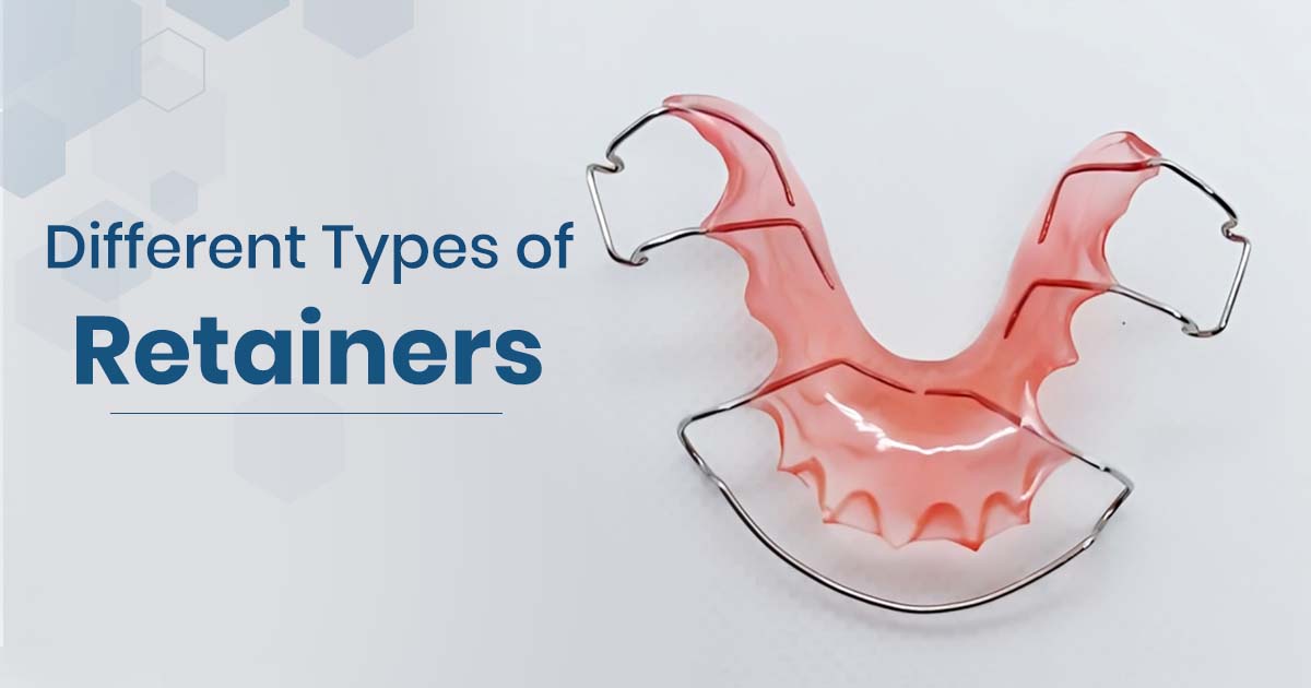 Types of Retainers in Dentistry… | Dentalkart Blogs